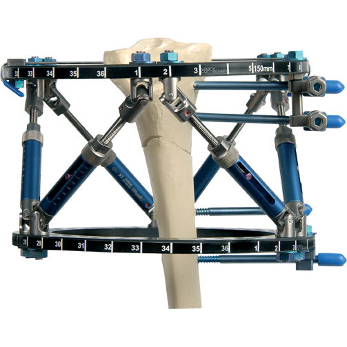 Fixateur externe modulaire - Smart Correction® - Response Ortho - circulaire