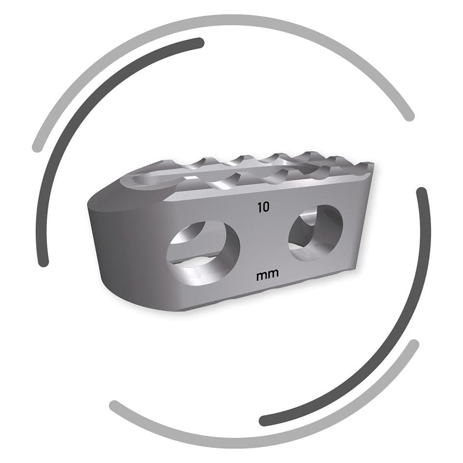 Cage intersomatique lombaire - TETRIS - Signus Medical - voie ...