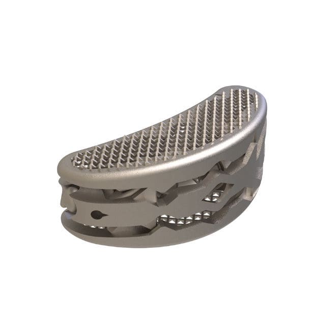 Cage intersomatique lombaire - Ustica TLIF - Tsunami Medical - voie ...