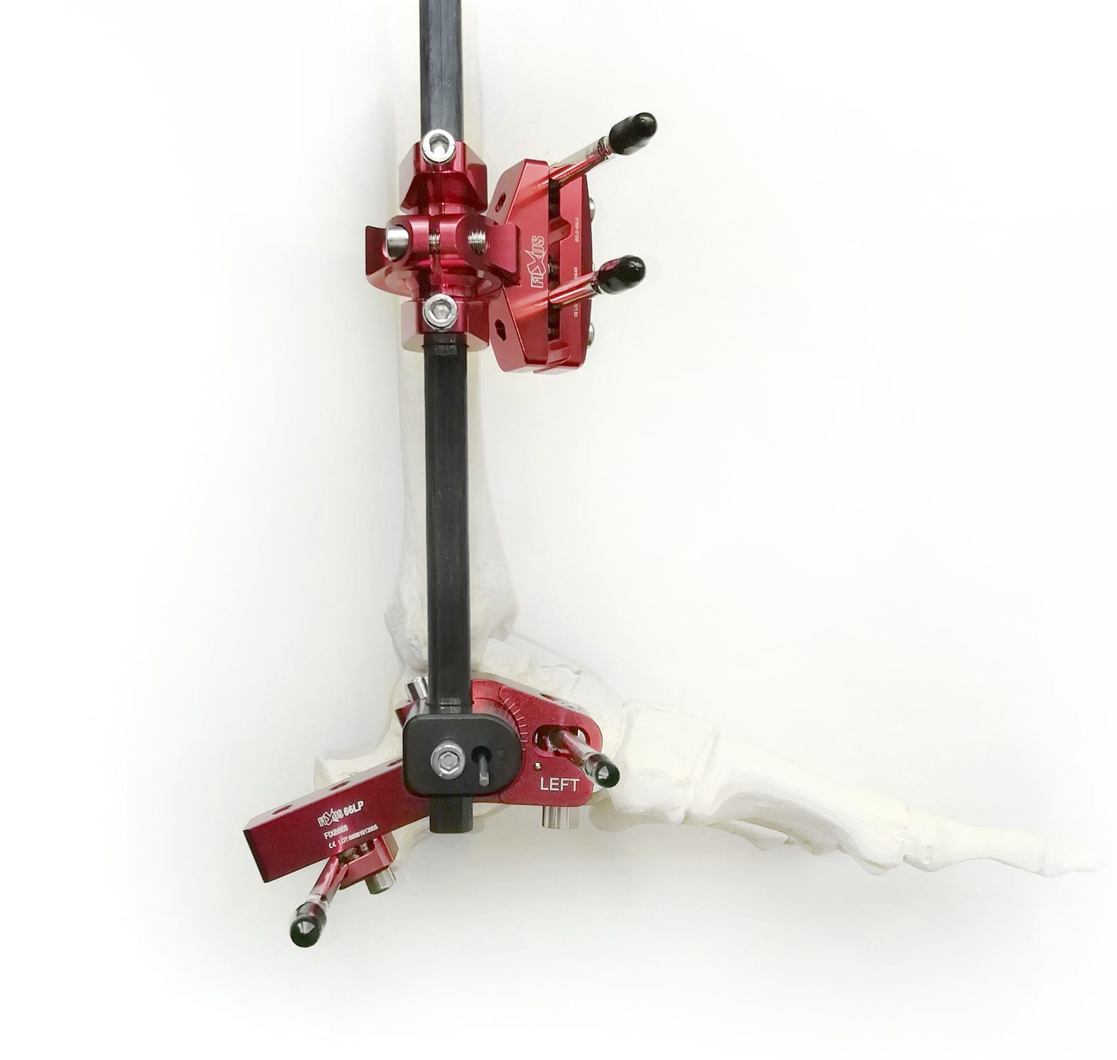 Fixateur externe de tibia - FIXUS66LP - Fixus - de cheville / calcanéum ...