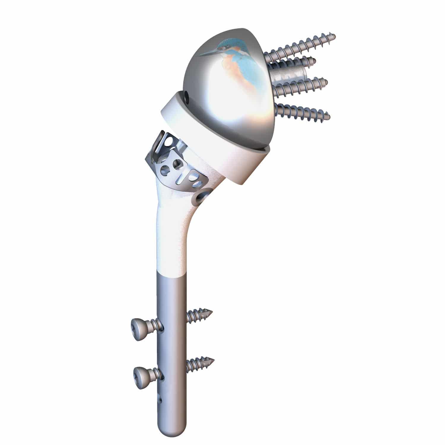 Tige humérale inversée - HUMELOCK II® - FX Solutions - non cimentée