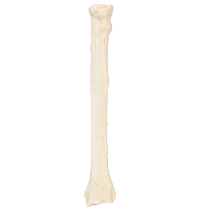 Modèle anatomique de radius - AV311 - Nacional Ossos - chirurgical / de ...