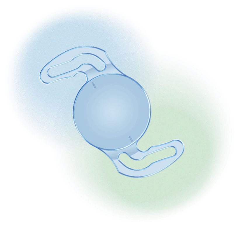 Lentille intraoculaire torique - EVToric - Aurolab - astigmatisme