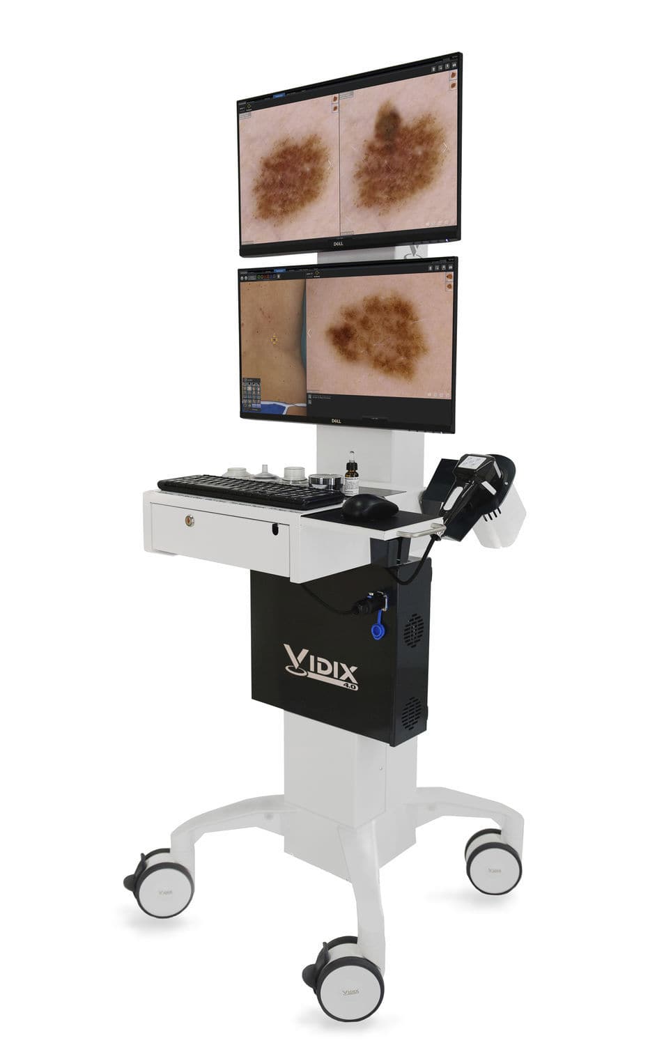 Dermatoscope vidéo - VIDIX 4.0 - CANFIELD - LED blanche / pour PC / Full HD