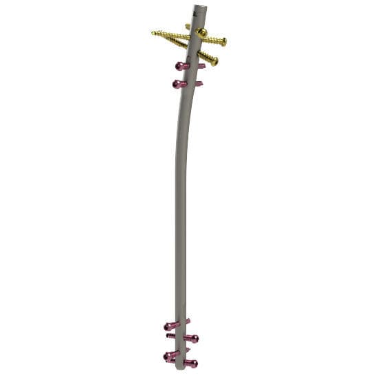 Clou intramédullaire de tibia - 4252 series - Zimed Medical - métallique