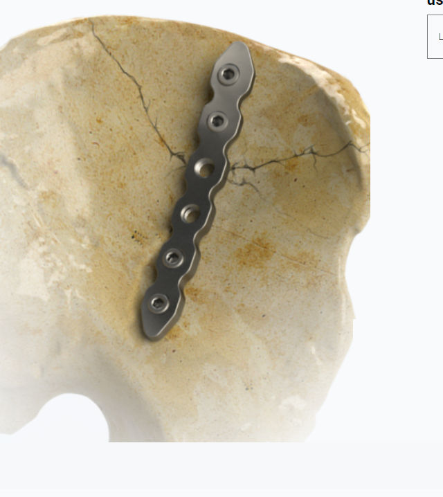 Plaque de compression de petit fragment osseux - 1422 series - Zimed ...