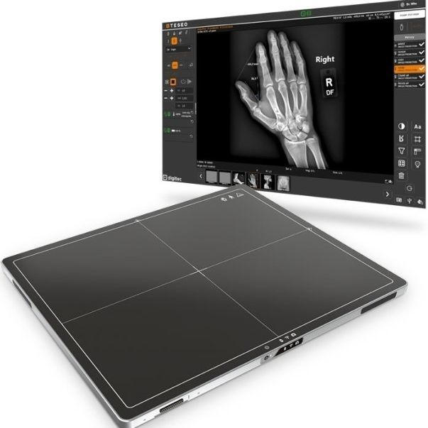 Capteur plan pour radiographie polyvalente - TeseoX - Digitec ...