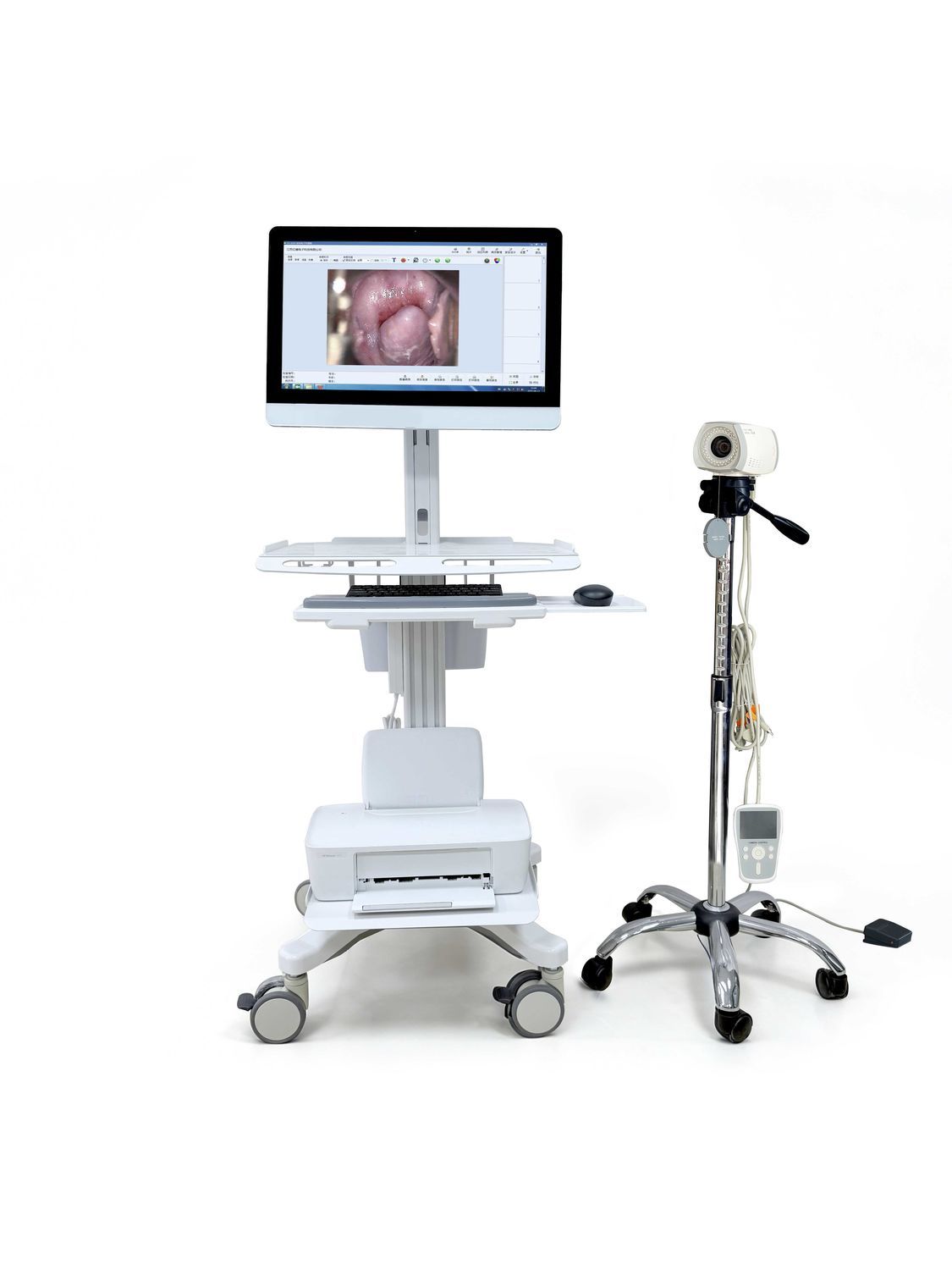 Colposcope vidéo - EK-6000F - Jiangsu Yikang Electronic Technology ...