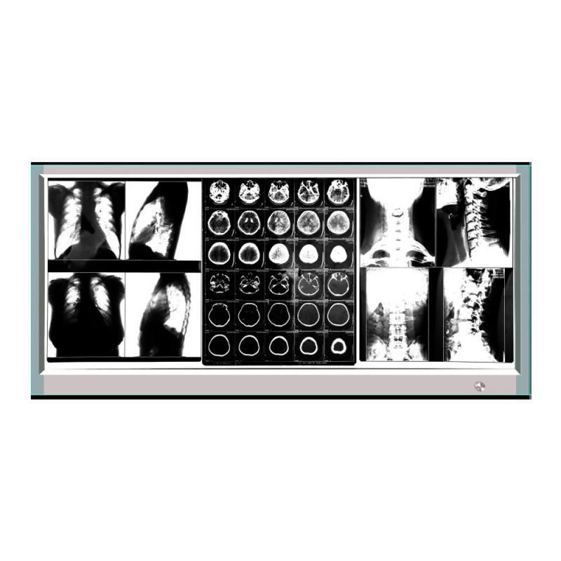 Négatoscope 3 plages - GP1003A - Bellamoon Medical - LED