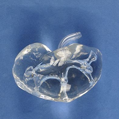 Modèle anatomique de bassin - Trando 3D Medical Technology - de rein ...