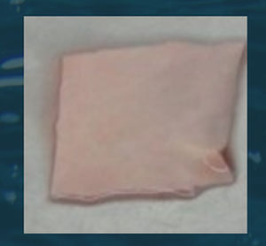 Matrice tissulaire cardiaque - CenoBiologics - allogreffe