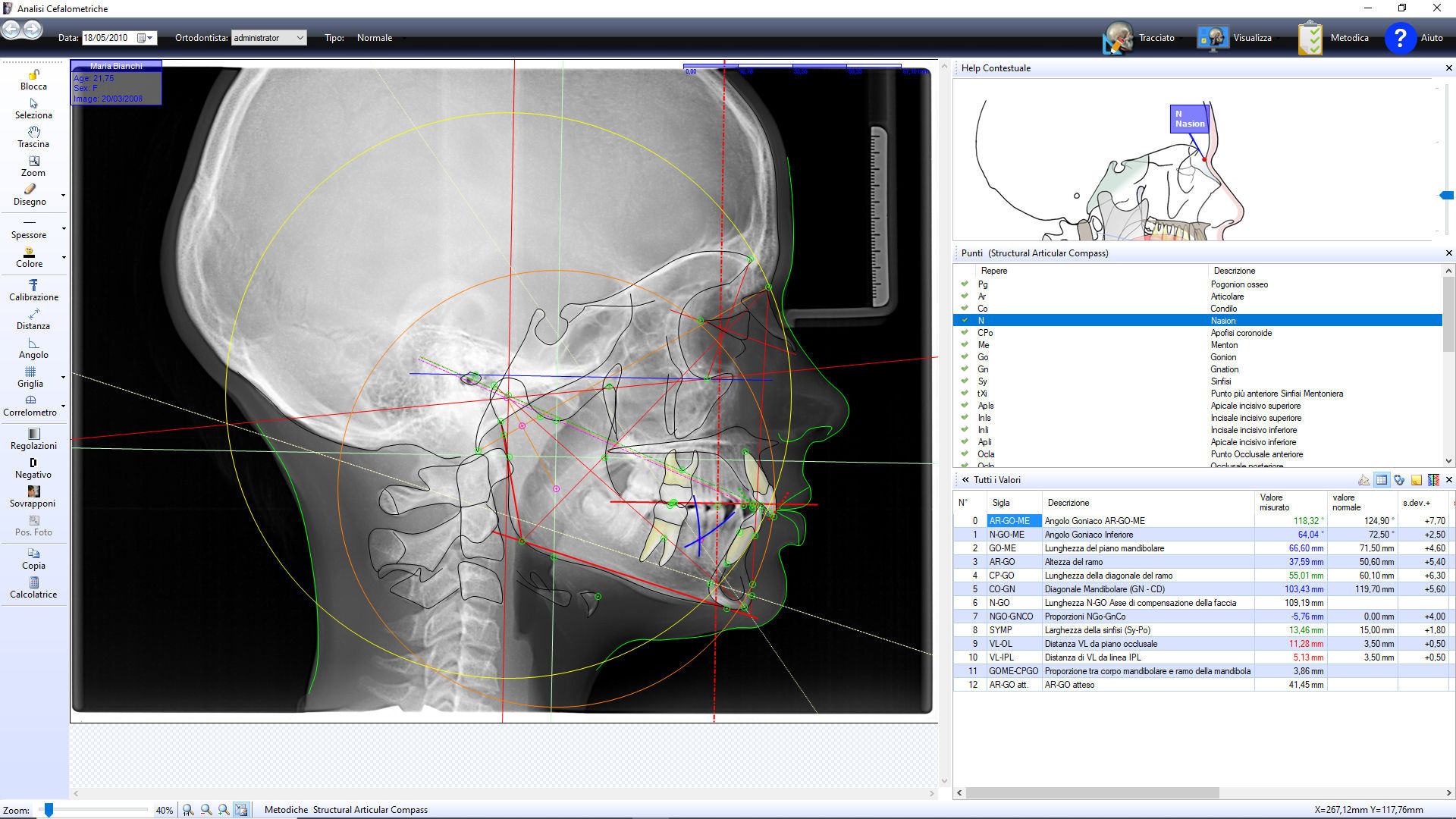 Logiciel d'analyse - OrthoTP - Microlab - pour orthodontie