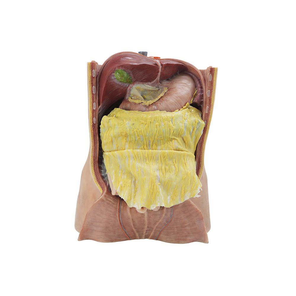 Modèle anatomique abdominal - MeiWo Science - de tronc cœliaque / d ...