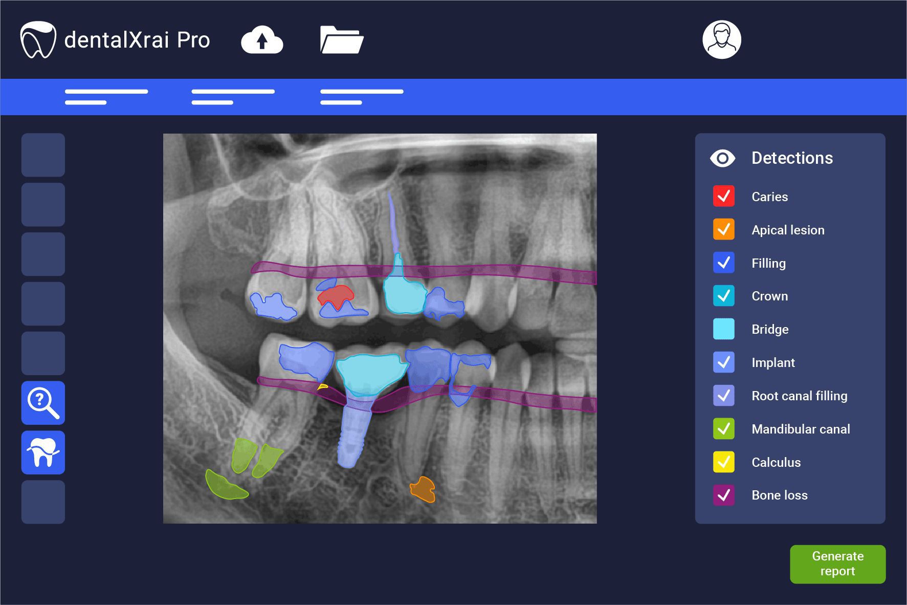 Logiciel d'analyse - dentalXrai Pro 3.0 - dentalXrai GmbH - d ...
