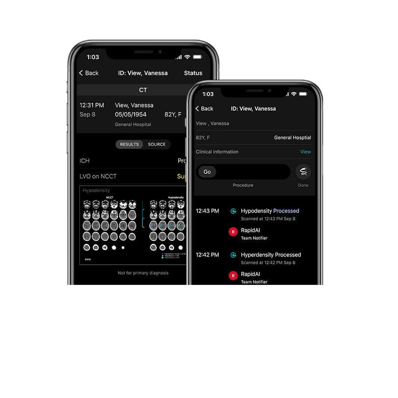 Application mobile de traitement - RapidAI - de partage / pour ...