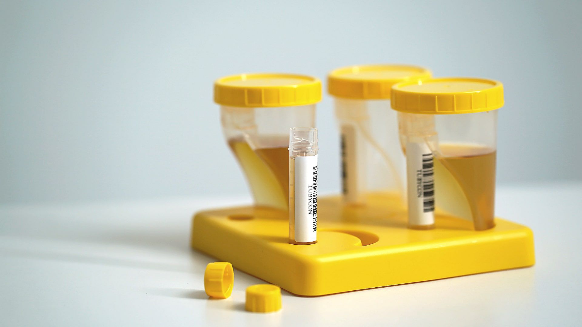 Tube à essai de laboratoire - M2 - TUBYCON Inc. - d'urine