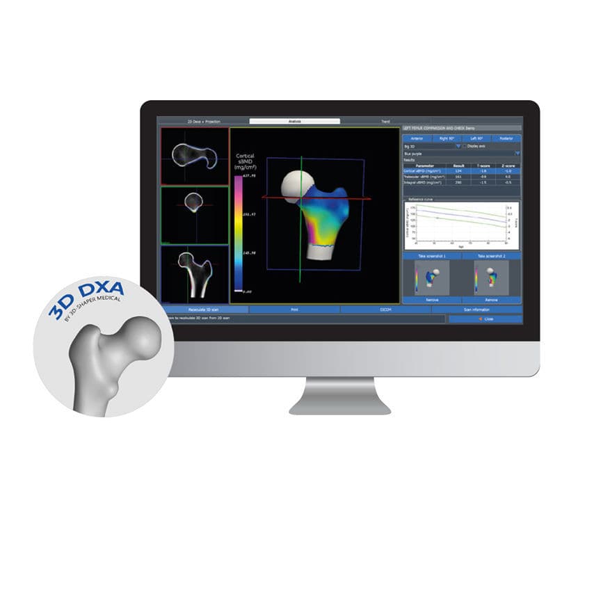 Logiciel de visualisation 3D - 3D-DXA - DMS Imaging - pour ...