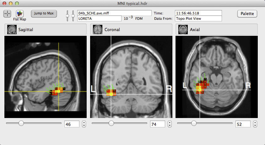 Système EEG avec cartographie EEG - GES 400 series - Electrical ...