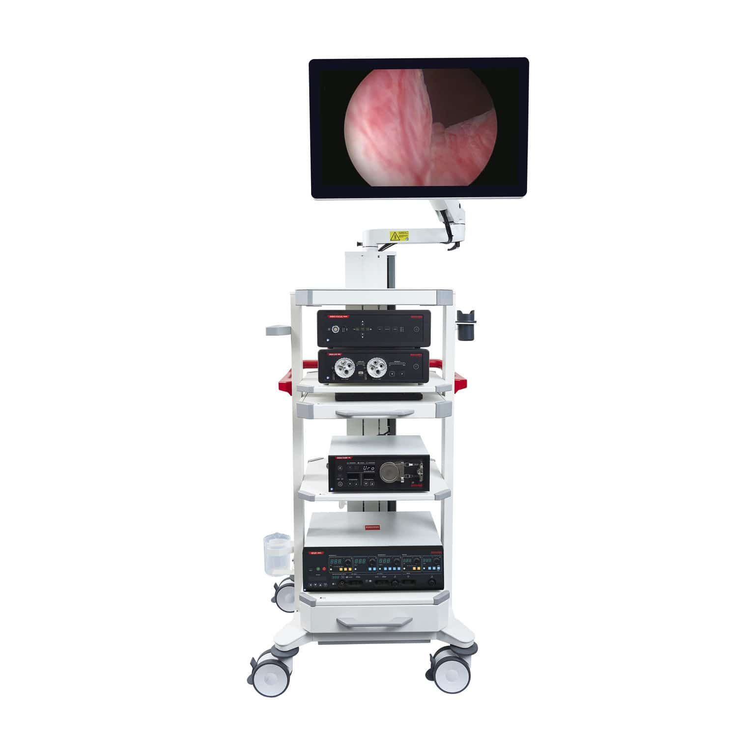 Colonne d'endoscopie pour chirurgie urologique endoscopique - Economy ...