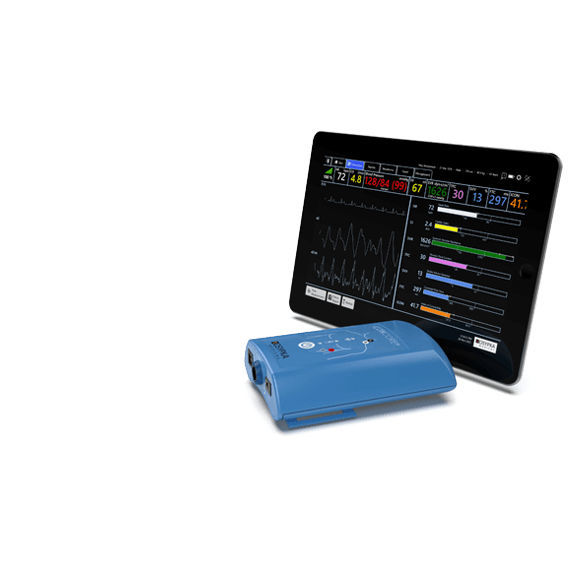 Moniteur de débit cardiaque non-invasif - ICONCORE® - Osypka Medical