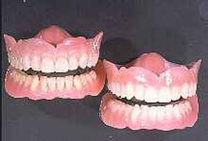 Prothèse dentaire en résine - Mdp - SOLTEC