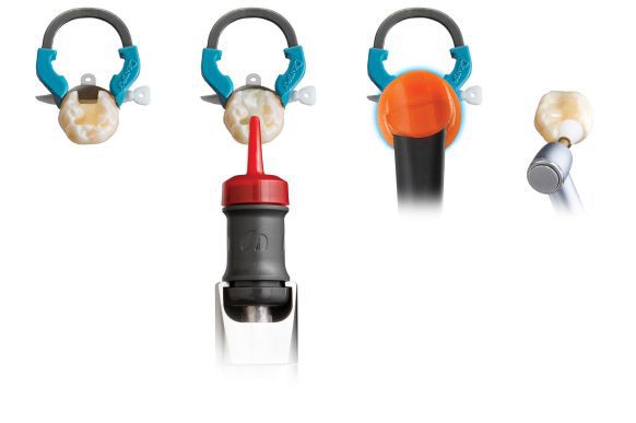 Matériau dentaire en composite hybride - Surefil one™ - Dentsply Sirona ...