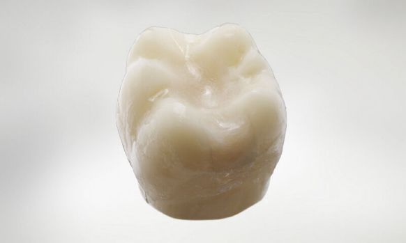 Matériau dentaire en composite hybride - Surefil one™ - Dentsply Sirona ...
