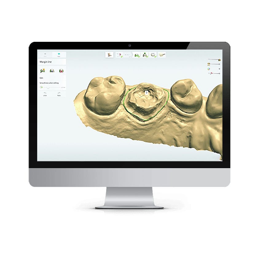 Logiciel de contrôle - TRIOS Design Studio - 3shape - de traitement / de conception / FAO