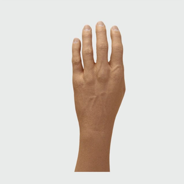 Épithèse de main - SG-PH/- - College Park - partielle / adulte