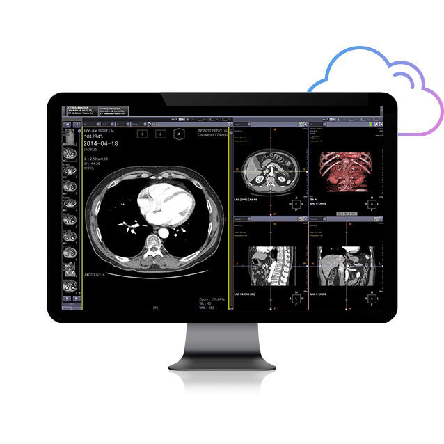 PACS basé sur le web - Smart Net - Infinitt Healthcare - médical