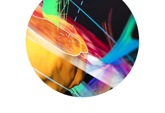 Logiciel avec système de suivi - Brainlab - de neuronavigation / de ...