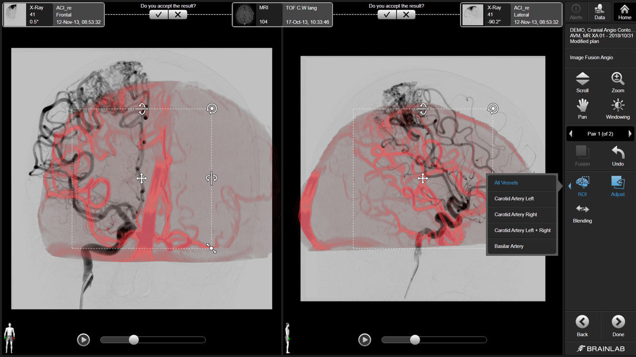 Logiciel de visualisation 3D - Brainlab - de diagnostic / de traitement / médical