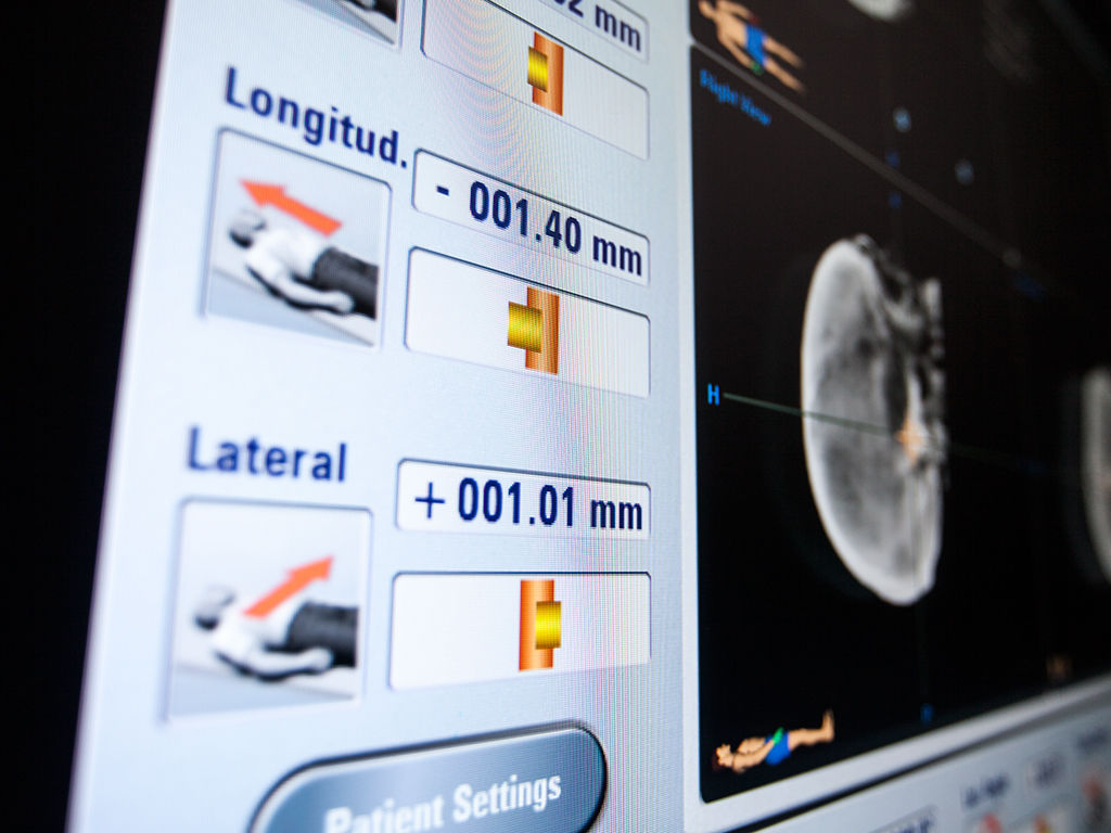 Système de CQ pour radiochirurgie - ExacTrac® - Brainlab - pour ...
