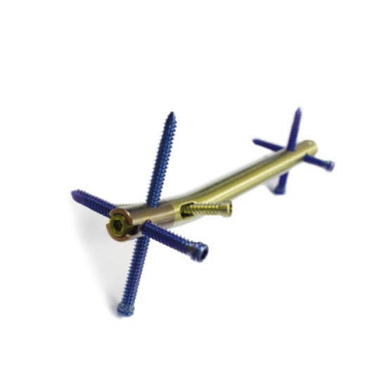 Clou intramédullaire de tibia - CHARFIX2 - ChM - de cheville / fixation ...