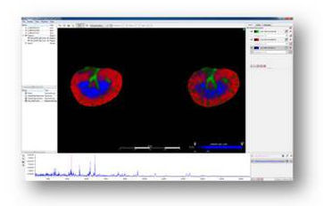 Logiciel d'analyse - SCiLS lab - Bruker Daltonics Inc. - de ...