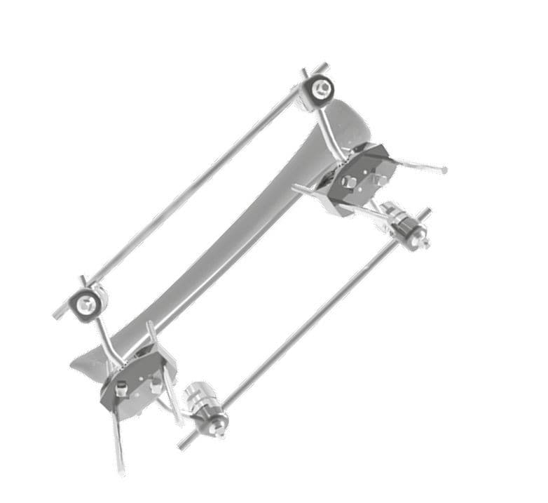 Fixateur externe de tibia - 206316 - SOFEMED International - tubulaire