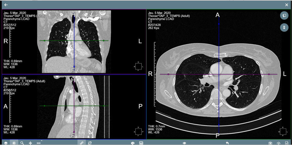 SIR pour imagerie médicale - Evolucare Imaging - EVOLUCARE - basé sur ...