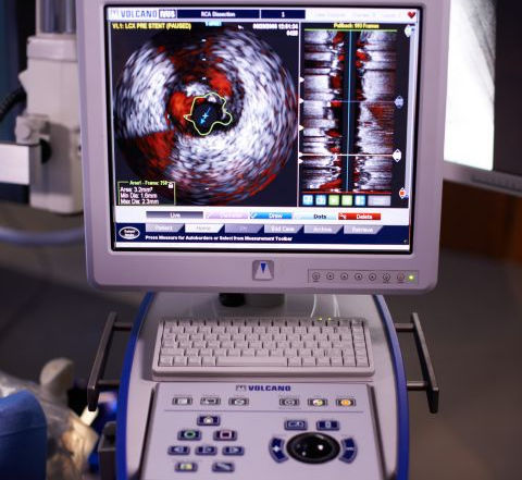 Échographe sur plateforme - CORE™ Mobile - Philips Volcano - pour ...