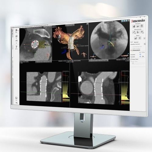 Logiciel de reporting - Pie Medical Imaging - de planification / de ...