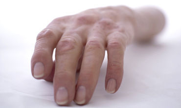 Épithèse de bras - Protunix - adulte