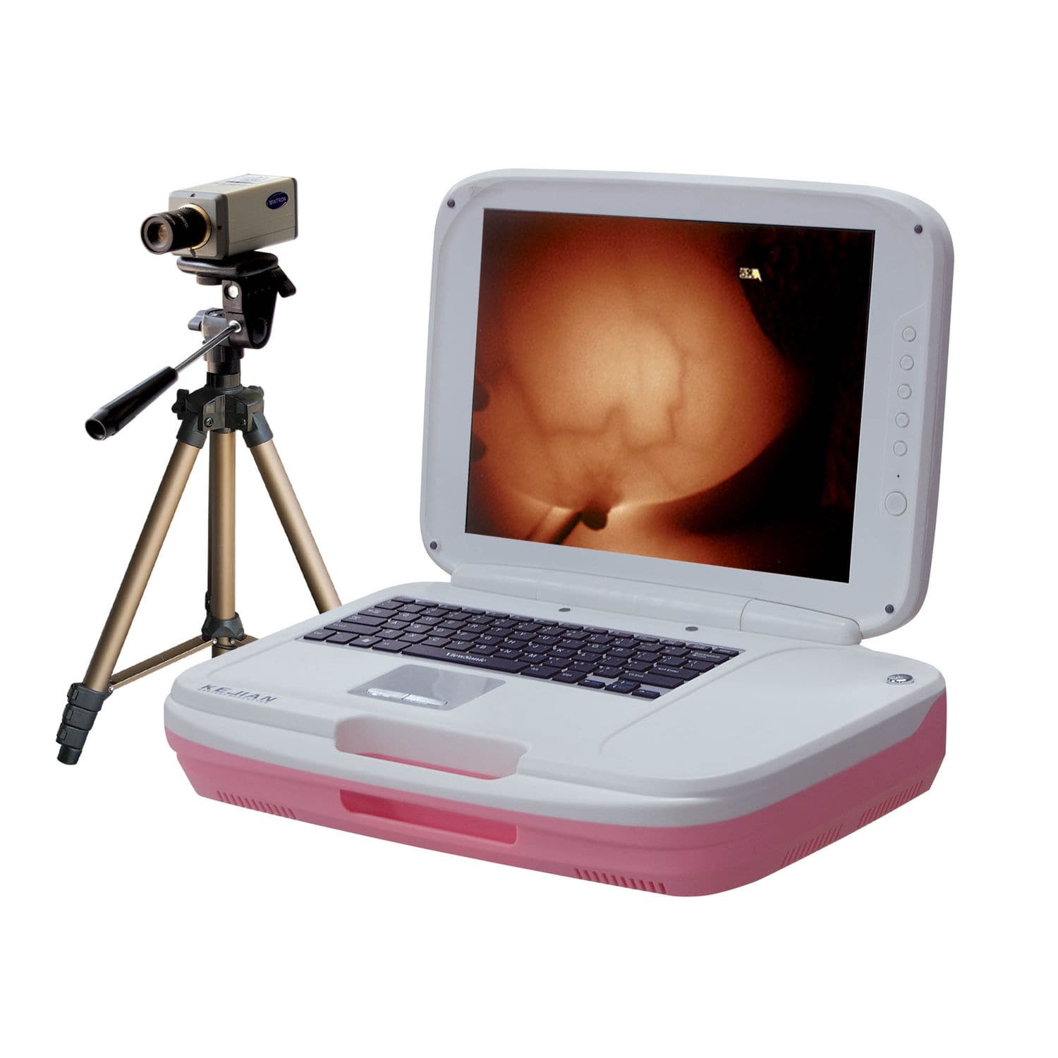 Colposcope vidéo - AD-1202 - Xuzhou Kejian Hi-tech - portable