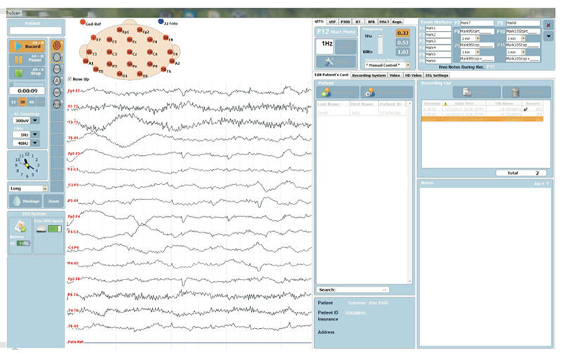 Système EEG 128 canaux - TruScan Research - Brainbox - pour la ...