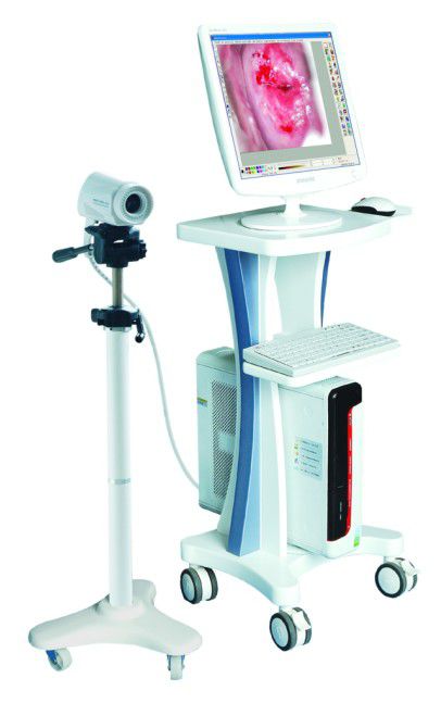Colposcope vidéo - LEO-2100I - Xuzhou Leo Medical Equipments - sur chariot