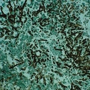 Réactif solution de coloration - Grocott MW - BIO-OPTICA Milano - pour ...