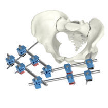 Fixateur externe - Tous les fabricants de matériel médical