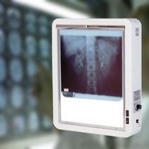 Négatoscope - Tous les fabricants de matériel médical