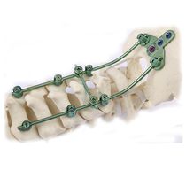 Système d’ostéosynthèse, Système d'ostéosynthèse vertébrale - Tous les ...