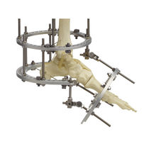 Fixateur externe cheville - Tous les fabricants de matériel médical - Vidéos