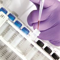 Réactif de laboratoire, Kit de réactifs de laboratoire - Tous les ...