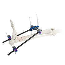 Fixateur externe - Tous les fabricants de matériel médical